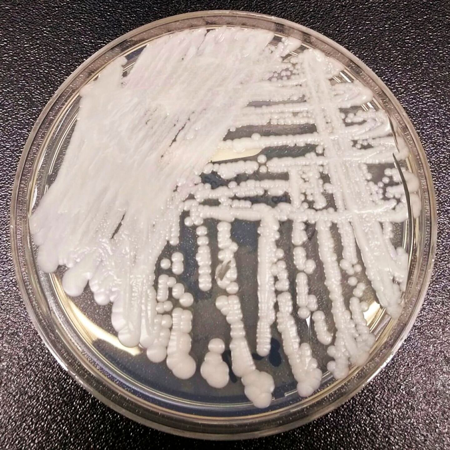 Asia Fact Check Lab: Will patients infected by a fungus in the U.S. die ...