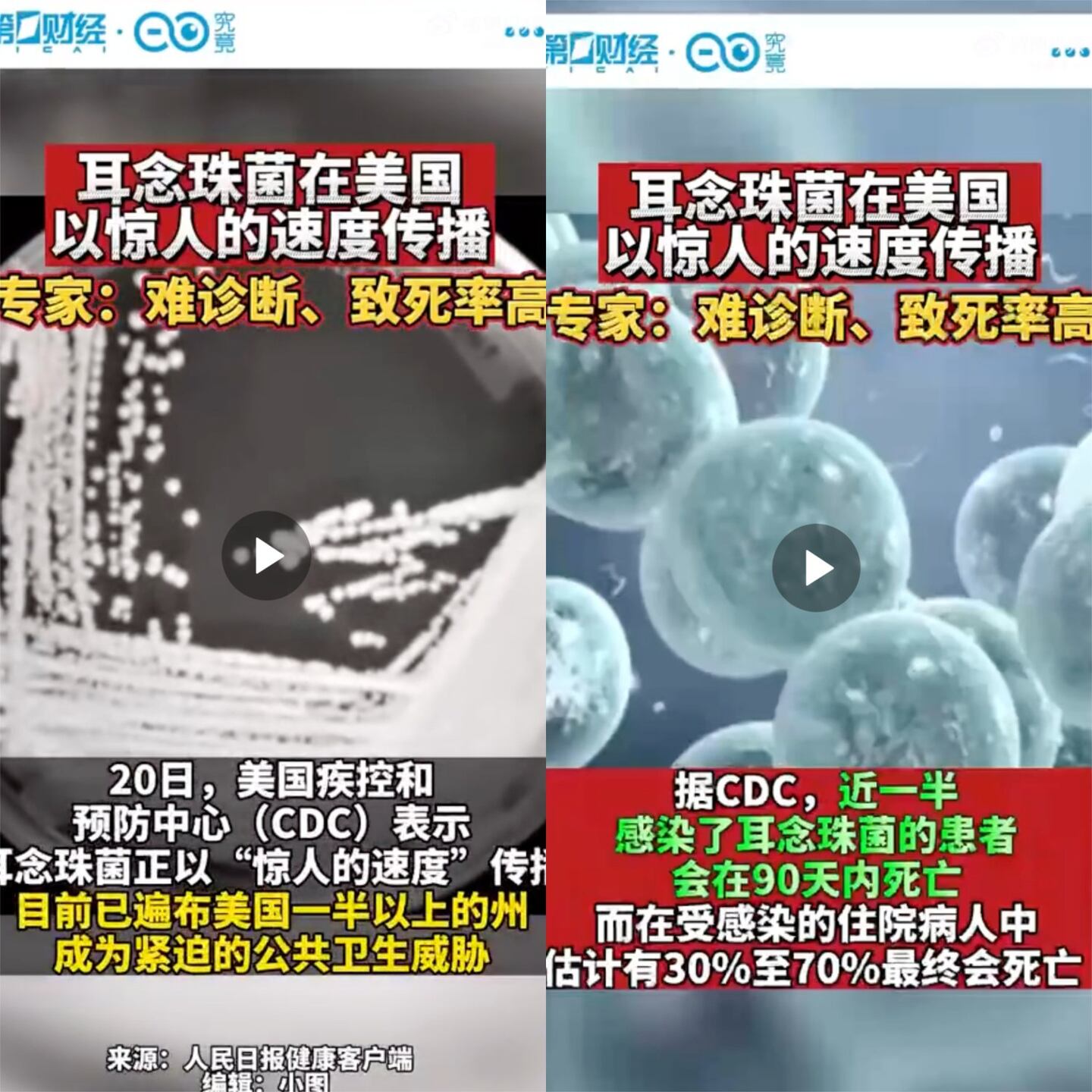 Asia Fact Check Lab: Will patients infected by a fungus in the U.S. die ...